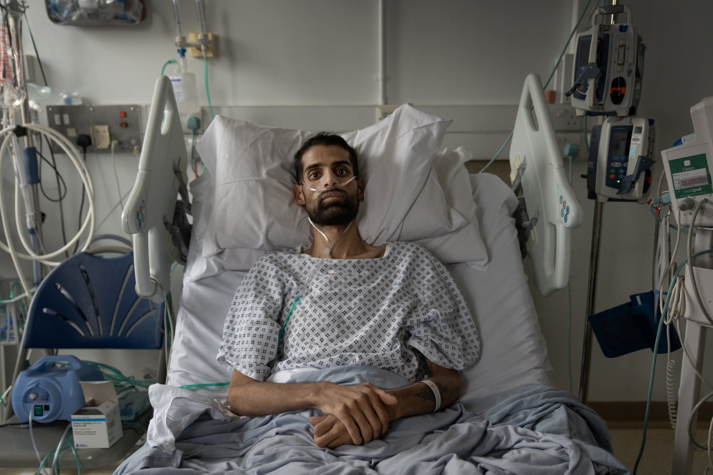 Deadly kitchen revamp lung disease on rise – as man sent for transplant ...