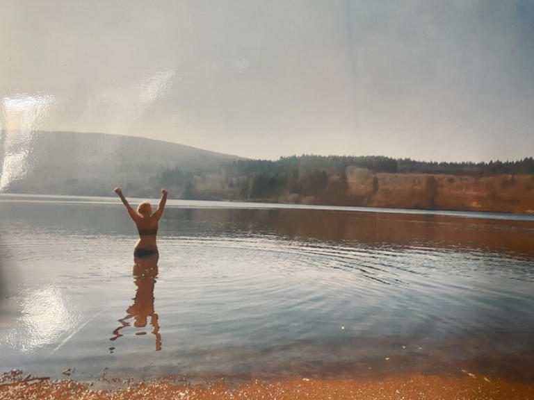 I've survived deadly sepsis six times