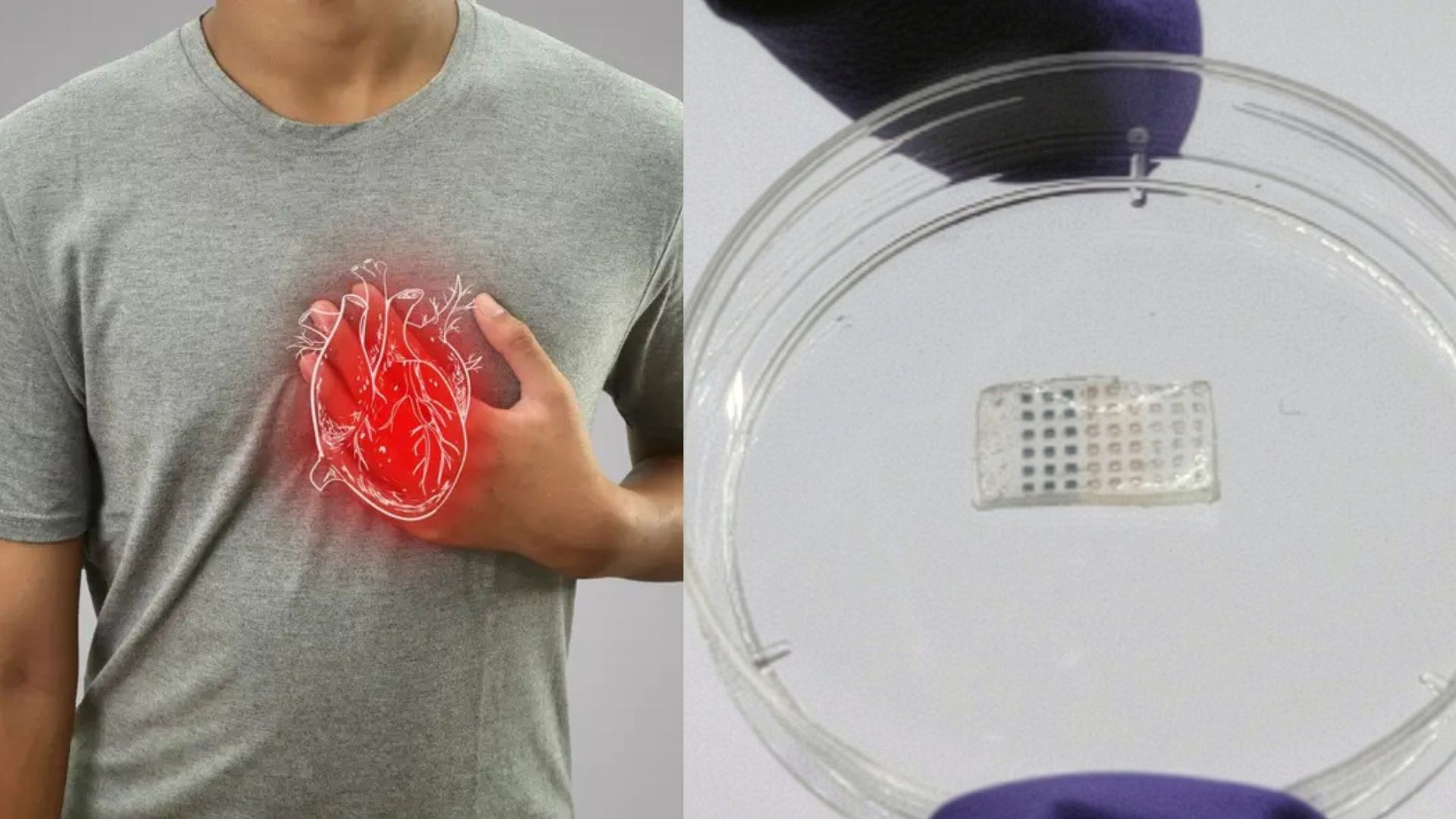 Flexible hydrogel heart patch cuts tissue damage by 50% and boosts ...