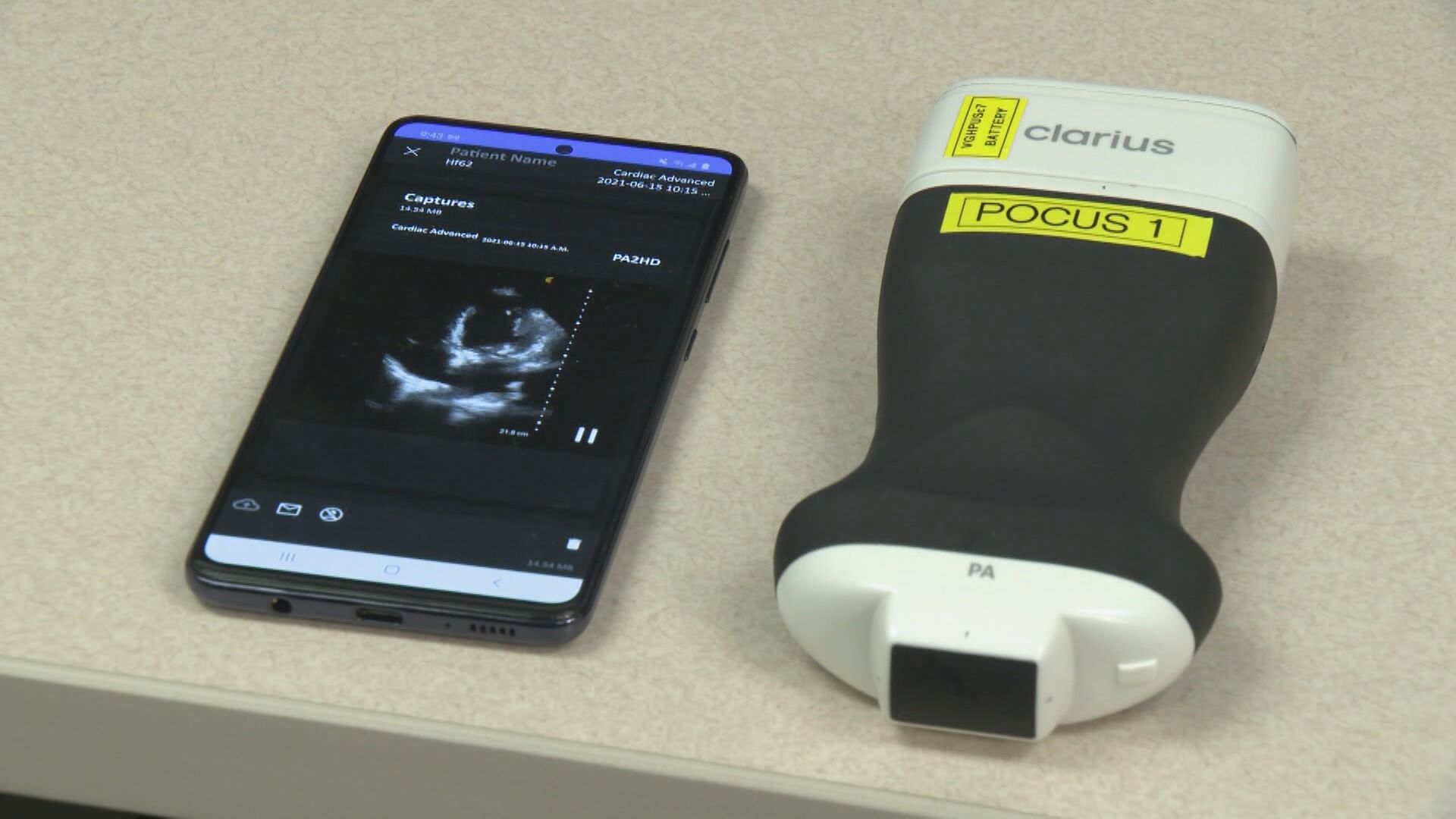 B.C. researchers using AI for cardiac care