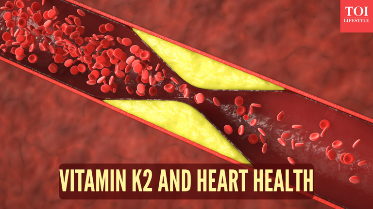 How Vitamin K2 Deficiency Is Silently Clogging Arteries And What Can 3737