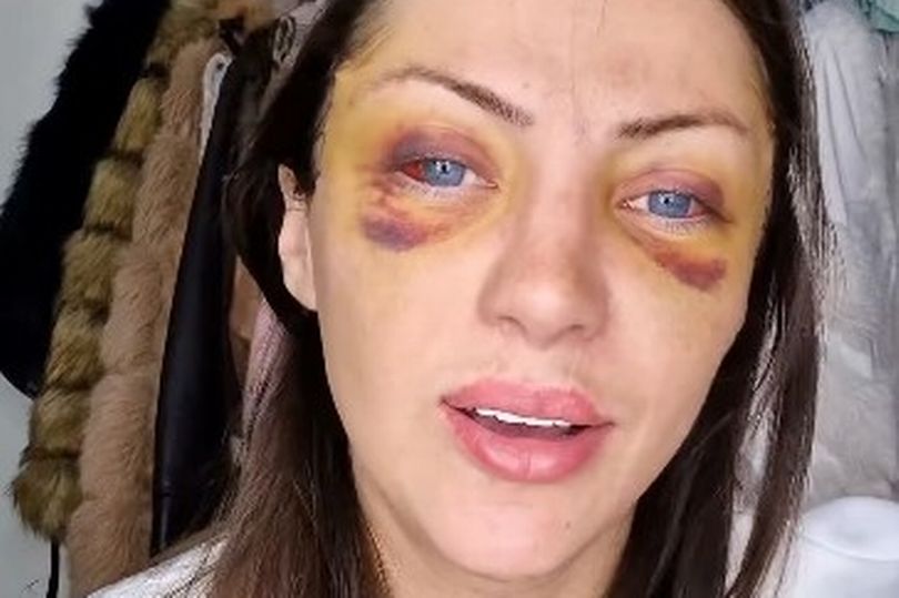 Mystery death of influencer 'Barbie Doll' after having nearly 30 ...