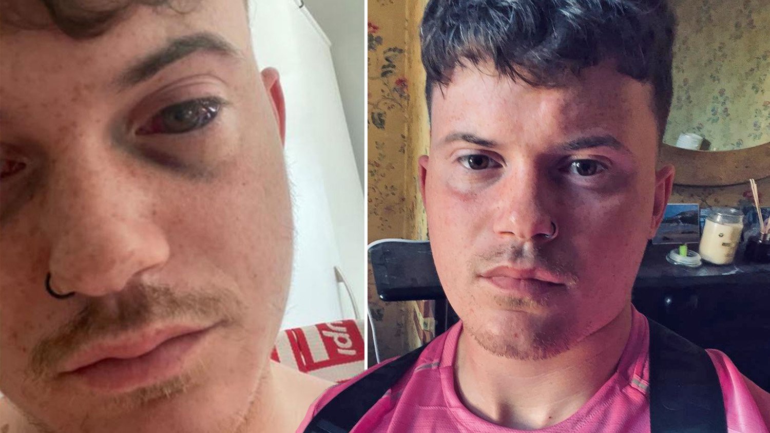 Ex-addict warns: Ketamine as harmful as heroin