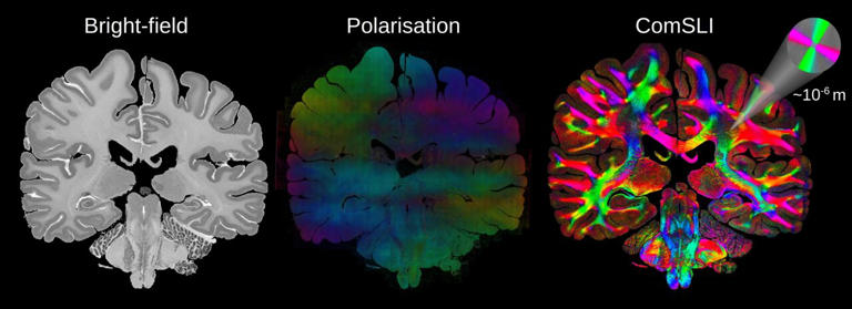Imaging technique maps the brain's nerve fiber labyrinth with ...