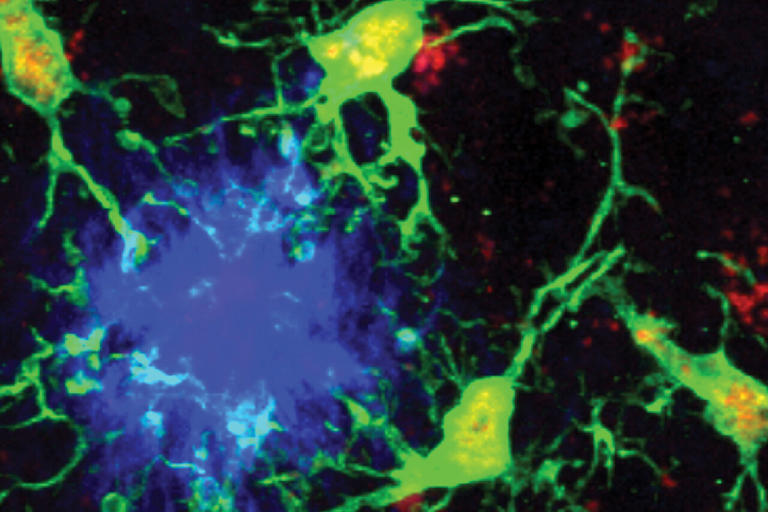 Protective microglia subtype offers potential therapeutic pathway in ...