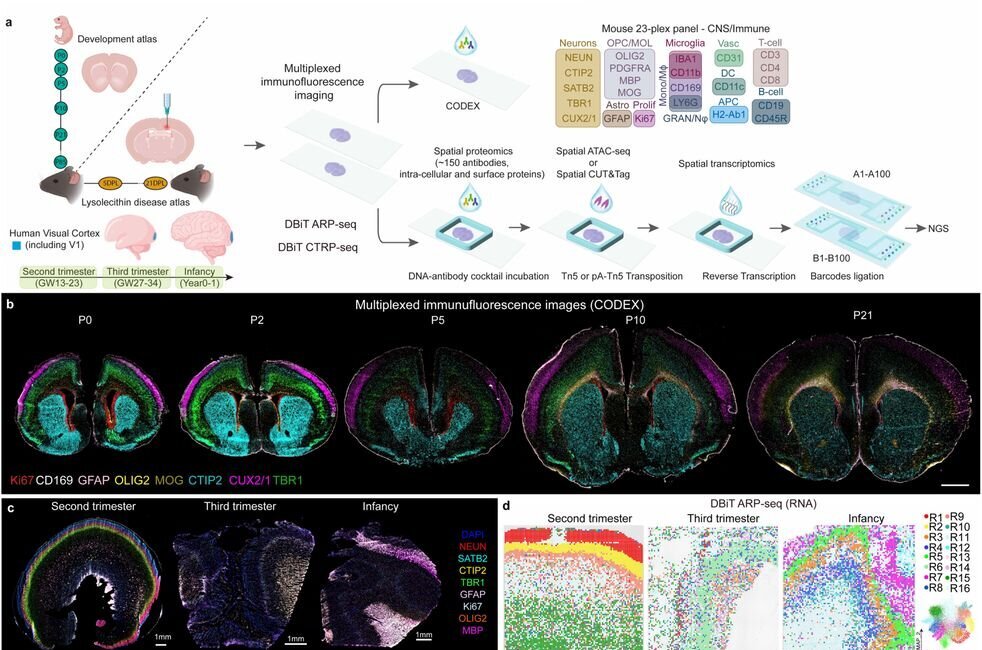 Multidimensional map shows how the brain develops—and how it resolves ...