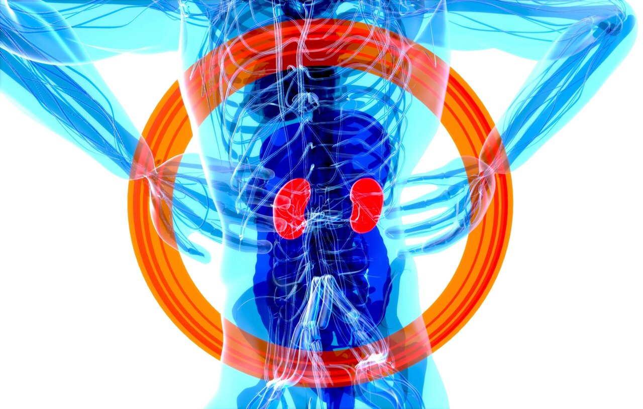 Chronic kidney disease is now the ninth leading cause of death, global ...