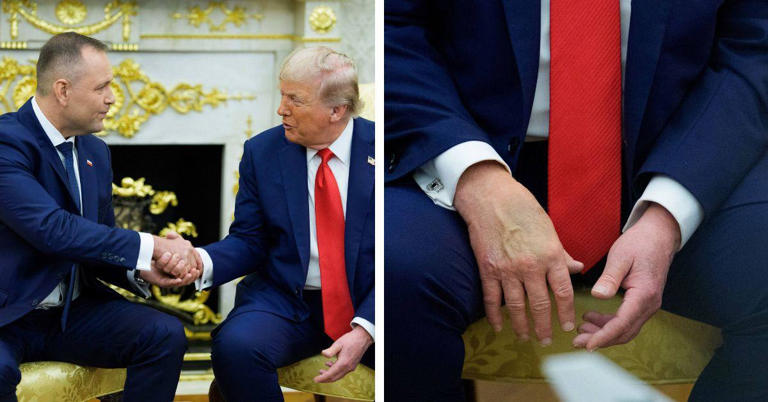 Donald Trump's Health Questioned by Top Ex-White House Doctor: 'There's ...