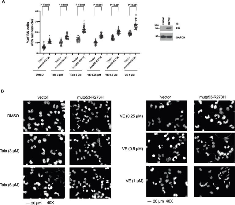 Certain p53 mutations may make tumors more vulnerable to immunotherapy