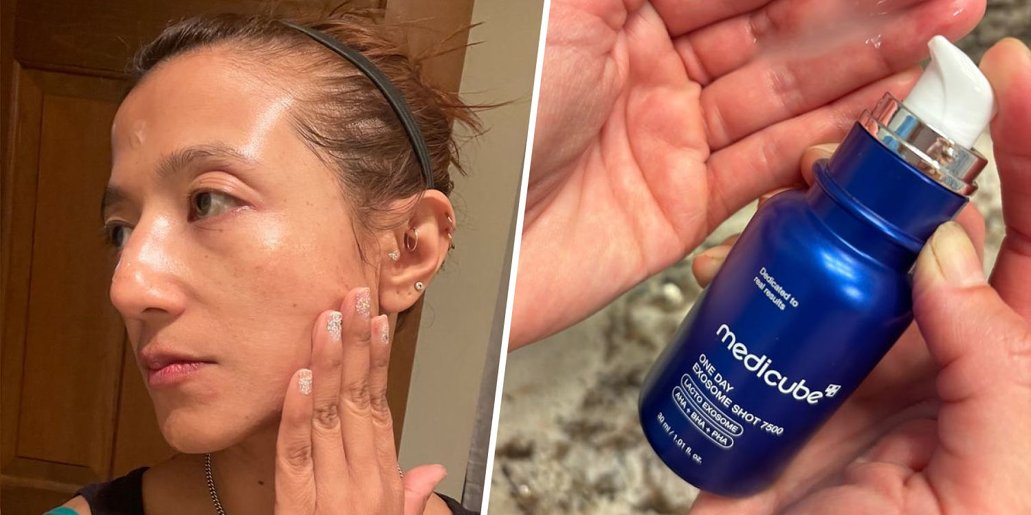 At 42, I Ditched Expensive Products For This 'Microneedling Serum' That ...