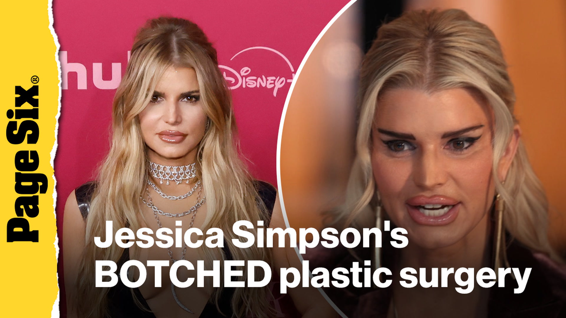 See Jessica Simpson's jaw-dropping BOTCHED plastic surgery face for her ...
