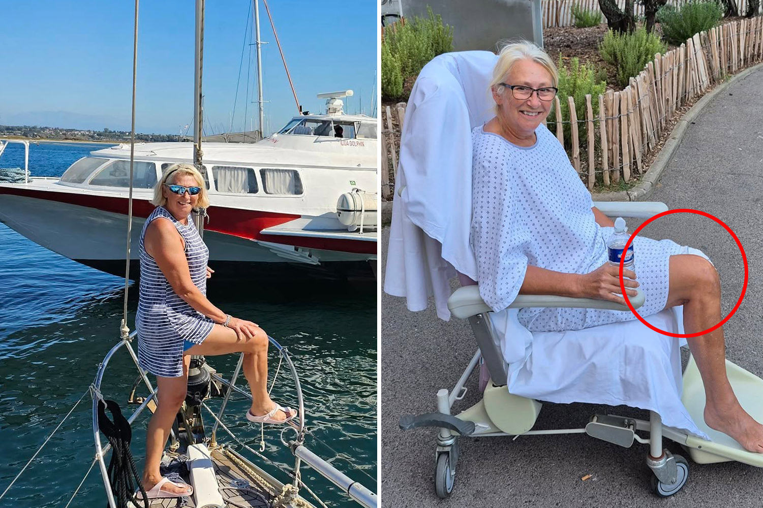 Split-second move on dream holiday sees Aussie woman's leg 'severed off ...