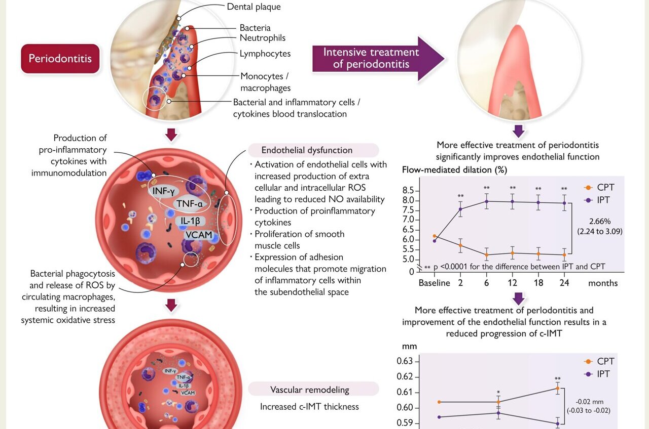 Treating gum disease could reduce risk of heart attacks and strokes