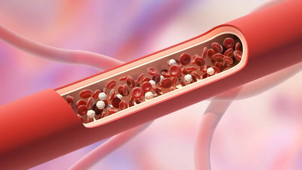 Doctor-backed method to avoid blood clots while flying