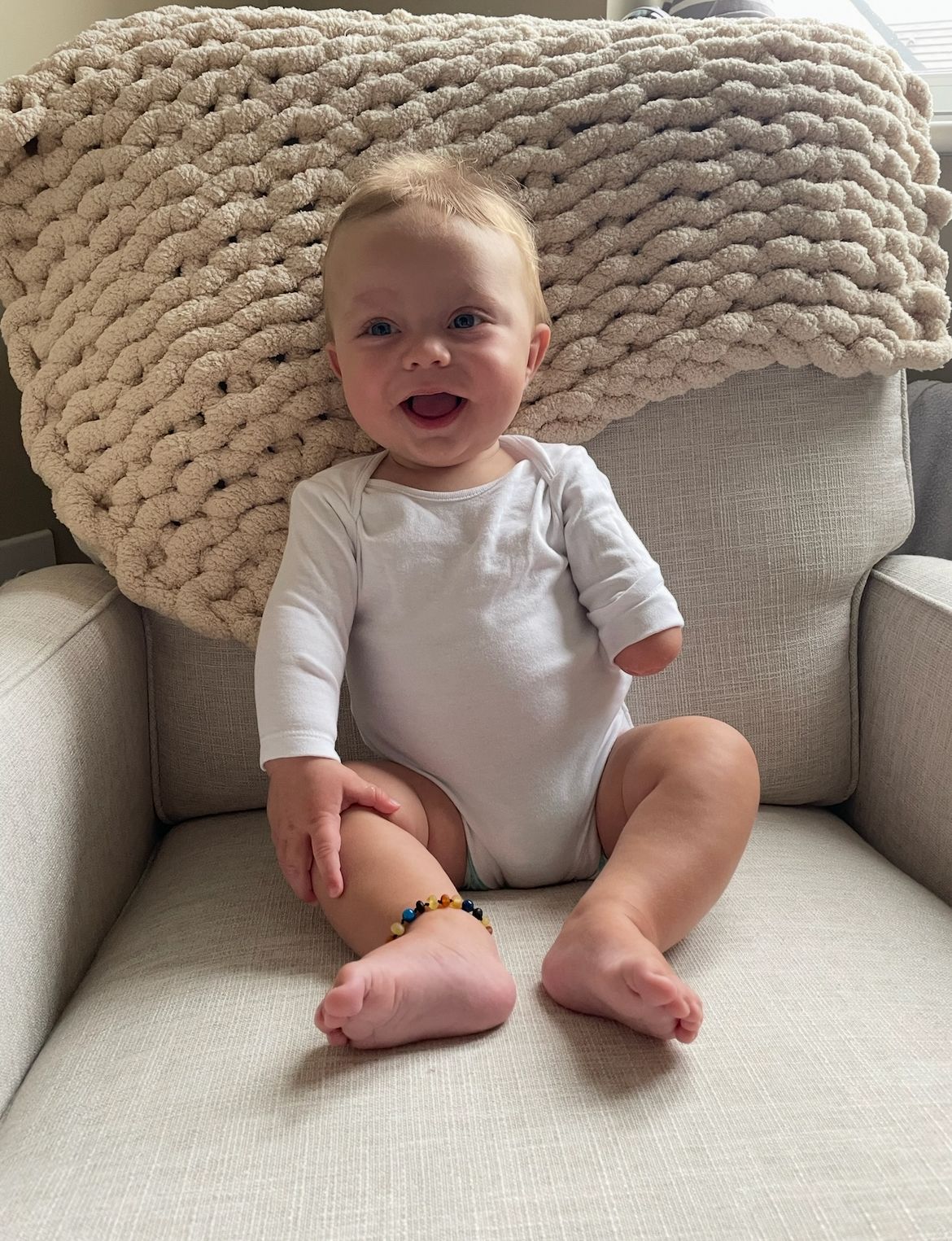 Parents get ‘massive shock’ after baby’s hand severed in the womb