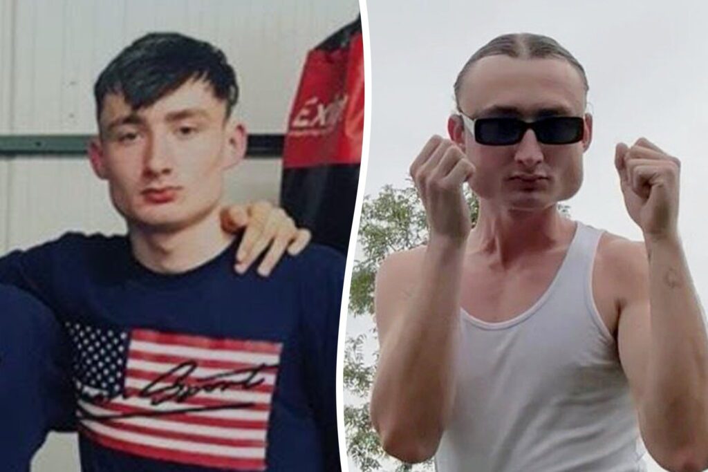 “People mock my square head – strangers say I look like Family Guy’s ...