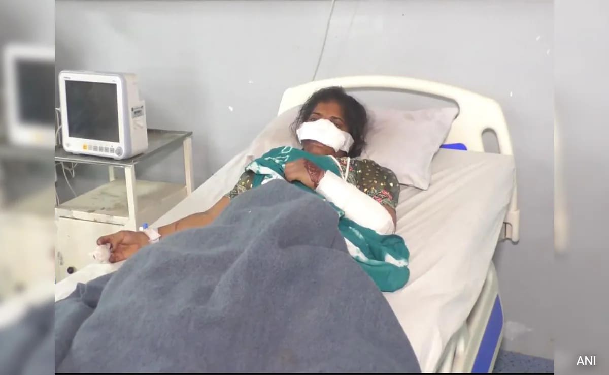 Madhya Pradesh Man Cuts Off Wife's Nose Over Suspected Infidelity