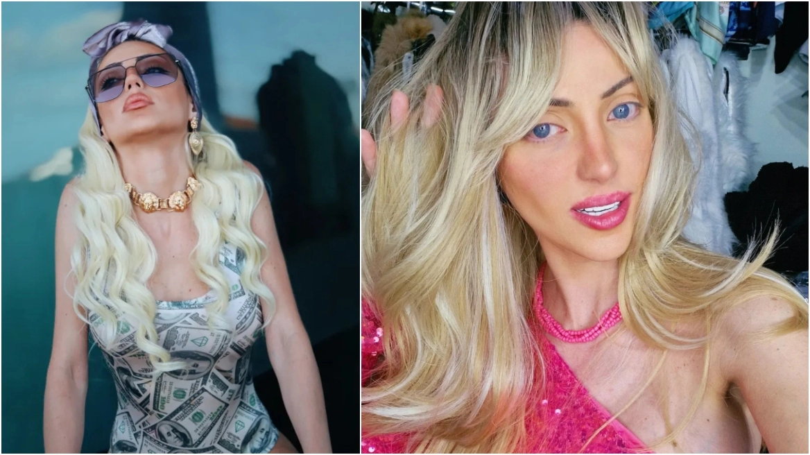 Νεκρή η influencer «Barbie» της Βραζιλίας με τις 27 εγχειρήσεις, ΦΩΤΟ