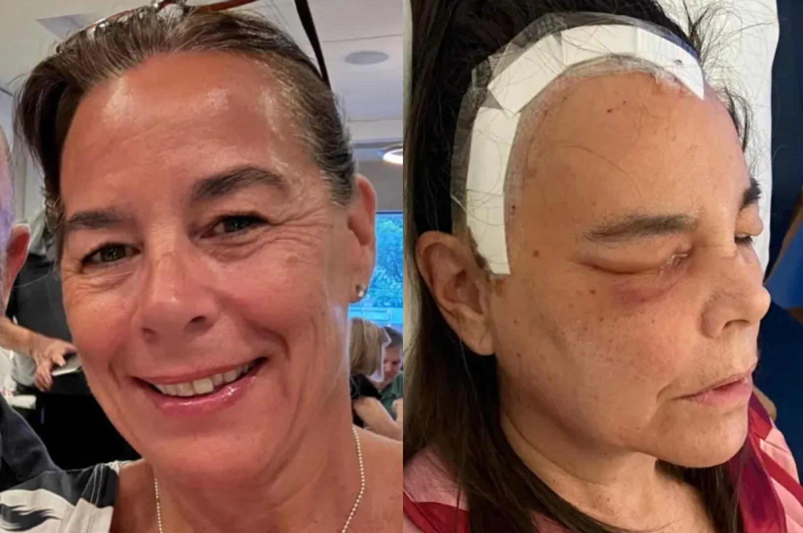 Mujer pasa dos años postrada por errores médicos y descubre un tumor ...