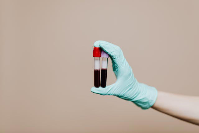 Studies Indicate That Individuals With This Blood Type Have a Higher ...