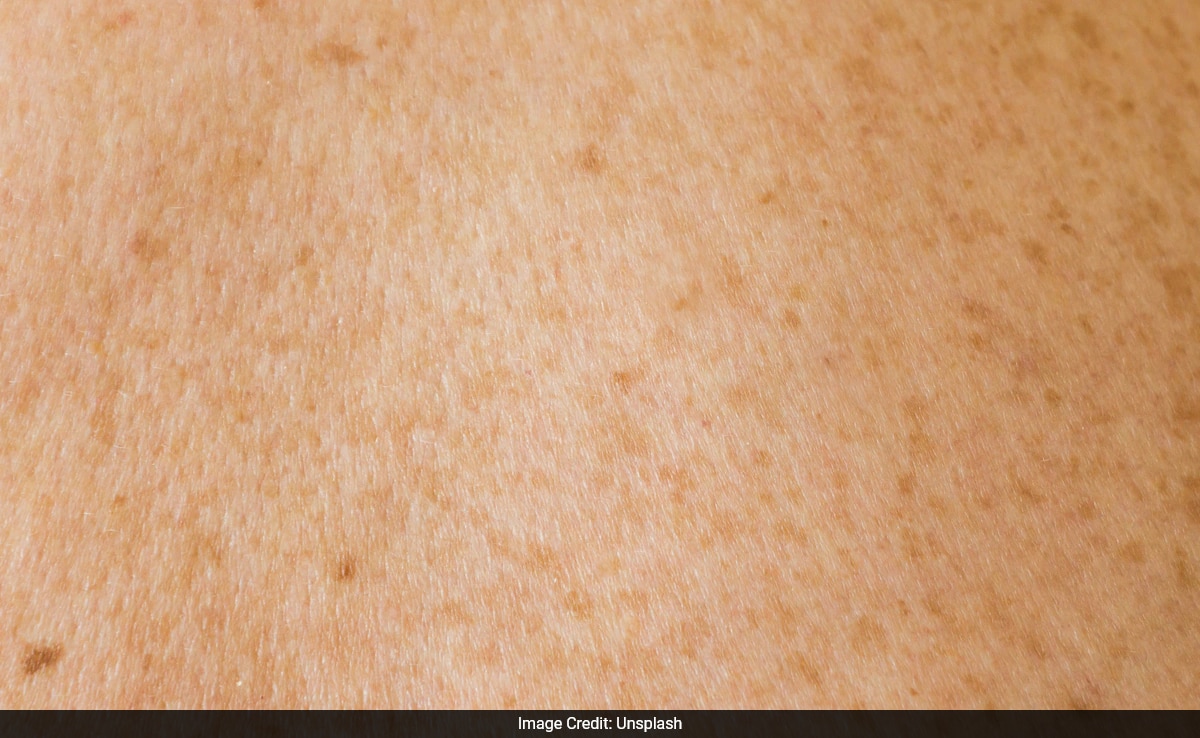 Chinese Woman Develops Snake-Like Skin Patterns After Using A 'Medicine ...