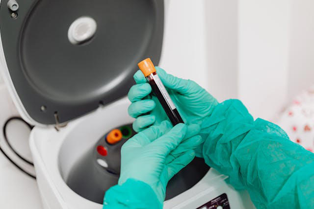 Studies Indicate That Individuals With This Blood Type Have a Higher ...