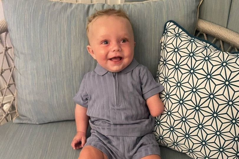 North East baby born with 'severed' arm after rare condition diagnosed ...