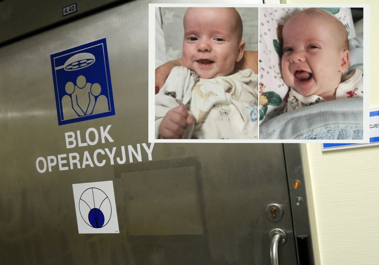 Wyjątkowa operacja bliźniaków. Ignaś i Wiktorek wracają do zdrowia