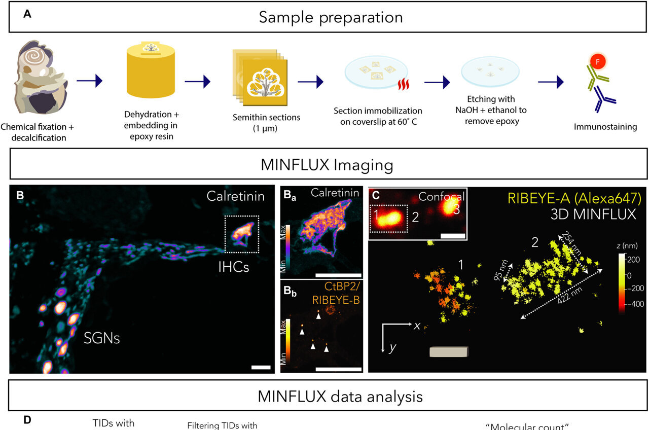 Teamwork in the inner ear: Our hearing is based on the organized ...