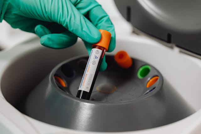 Studies Indicate That Individuals With This Blood Type Have a Higher ...