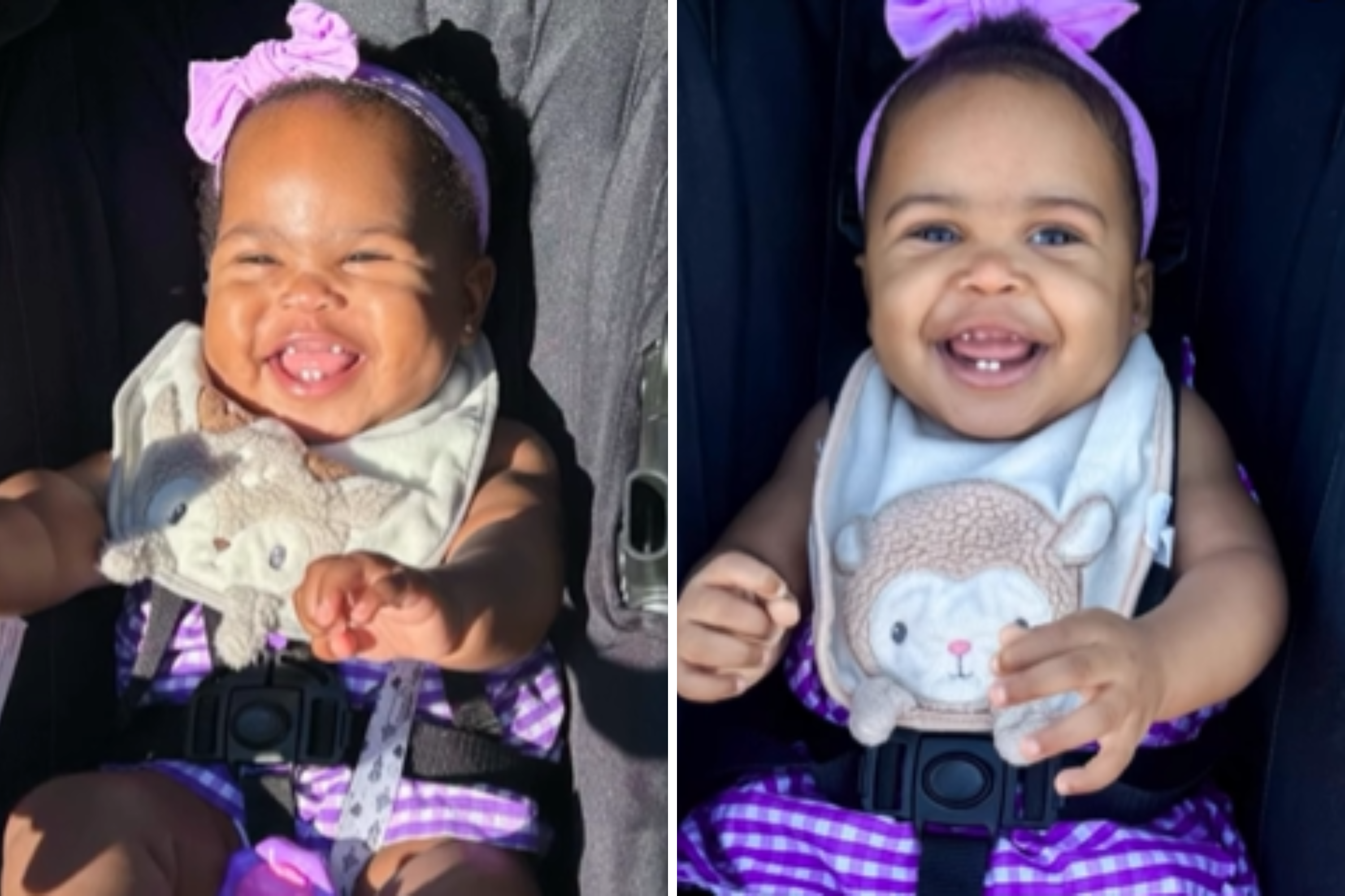 Mom notices baby’s teeth coming in—then sees something very unusual