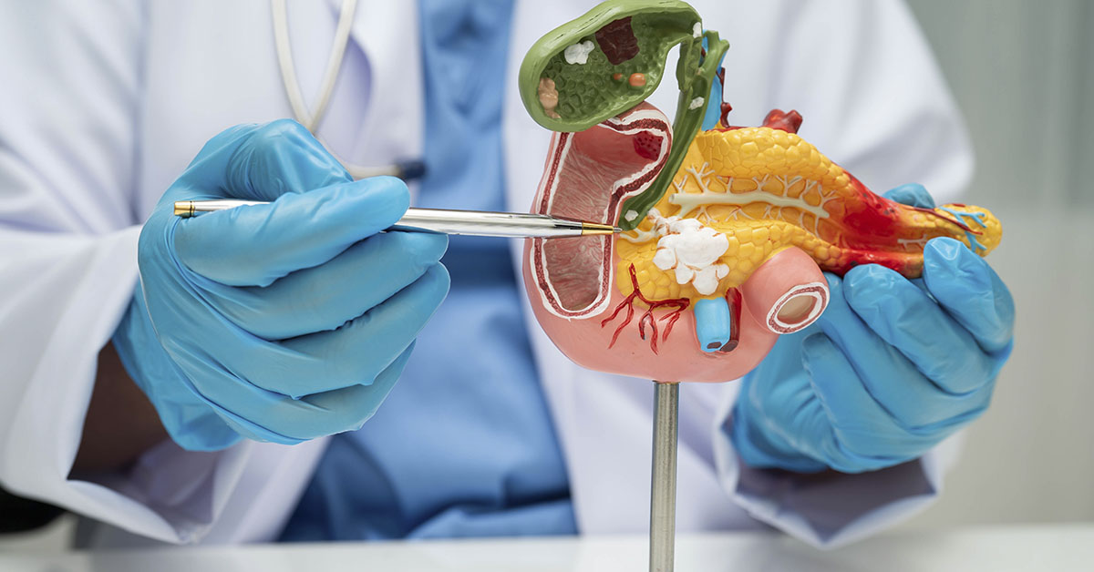 Pancreatic Cancer: 4 Leg Symptoms You Might Be Overlooking