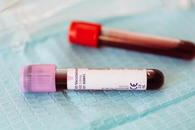 Studies Indicate That Individuals With This Blood Type Have a Higher ...