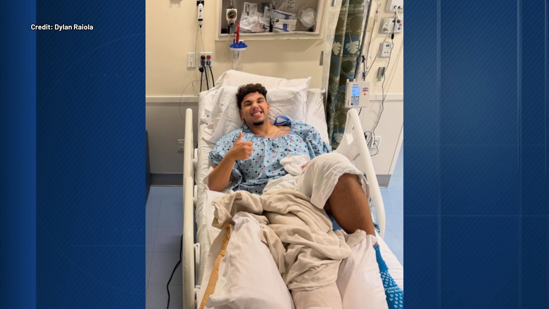 Nebraska quarterback Dylan Raiola undergoes successful surgery for ...