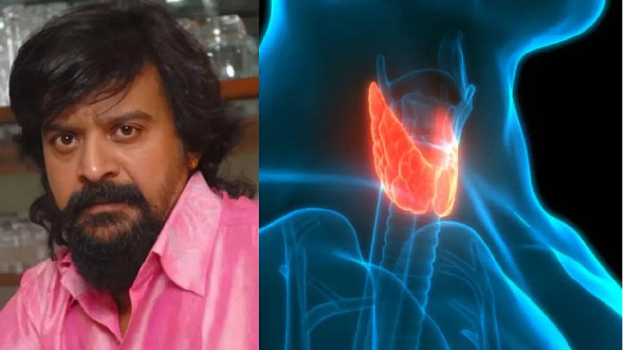 Is Your Daily Milk Consumption Putting Your Heart at Risk? Scientists ...