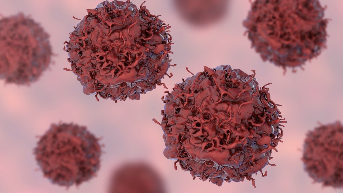 Two decades of evolution: How blood cancer treatment has transformed ...
