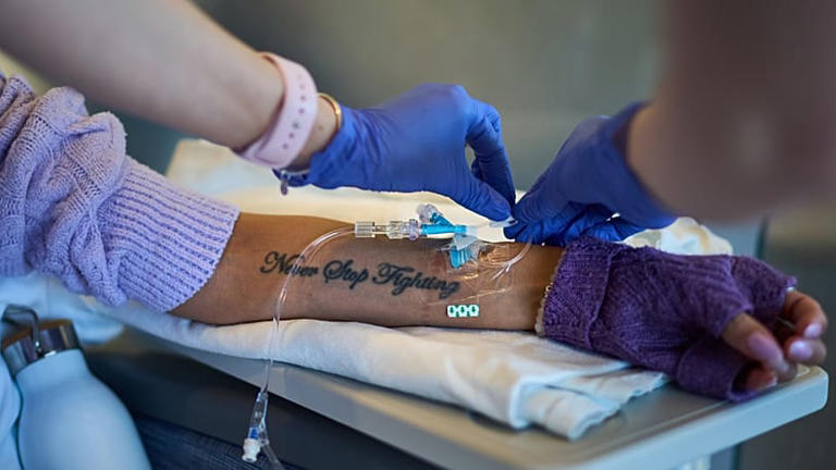 Lupus, the disease of 1,000 faces, shows how science is tackling ...