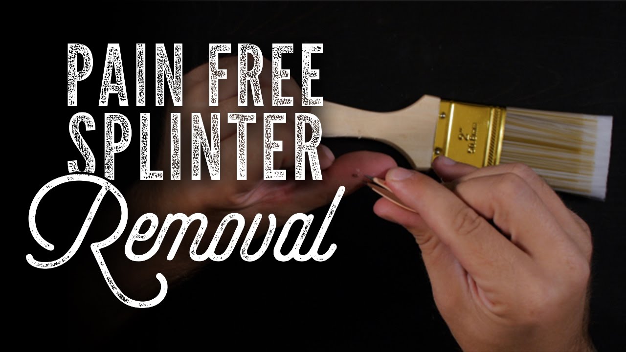 How to painlessly remove splinters from your skin