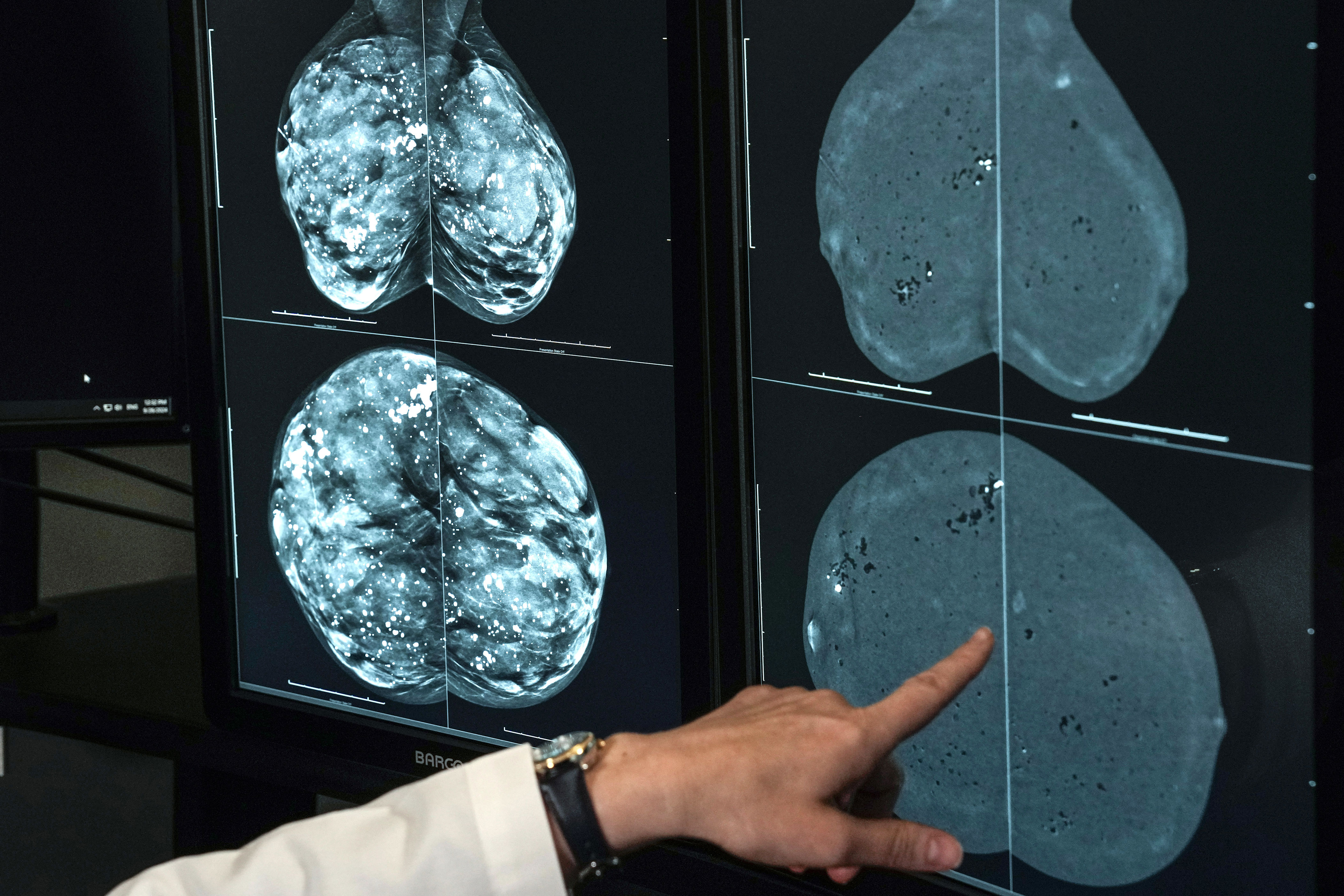 What you can do now to help avoid cancer later