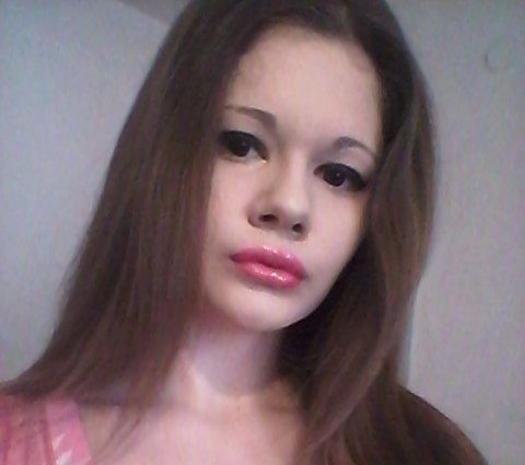 I’ve paid £20,000 and had 32 injections to have the world’s biggest lips