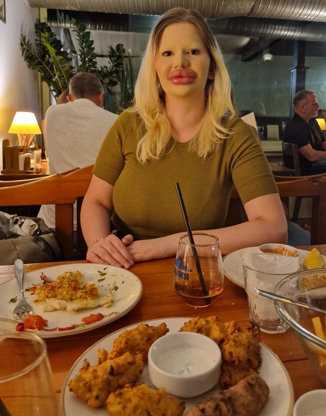 Woman spends £20k on world's biggest lips