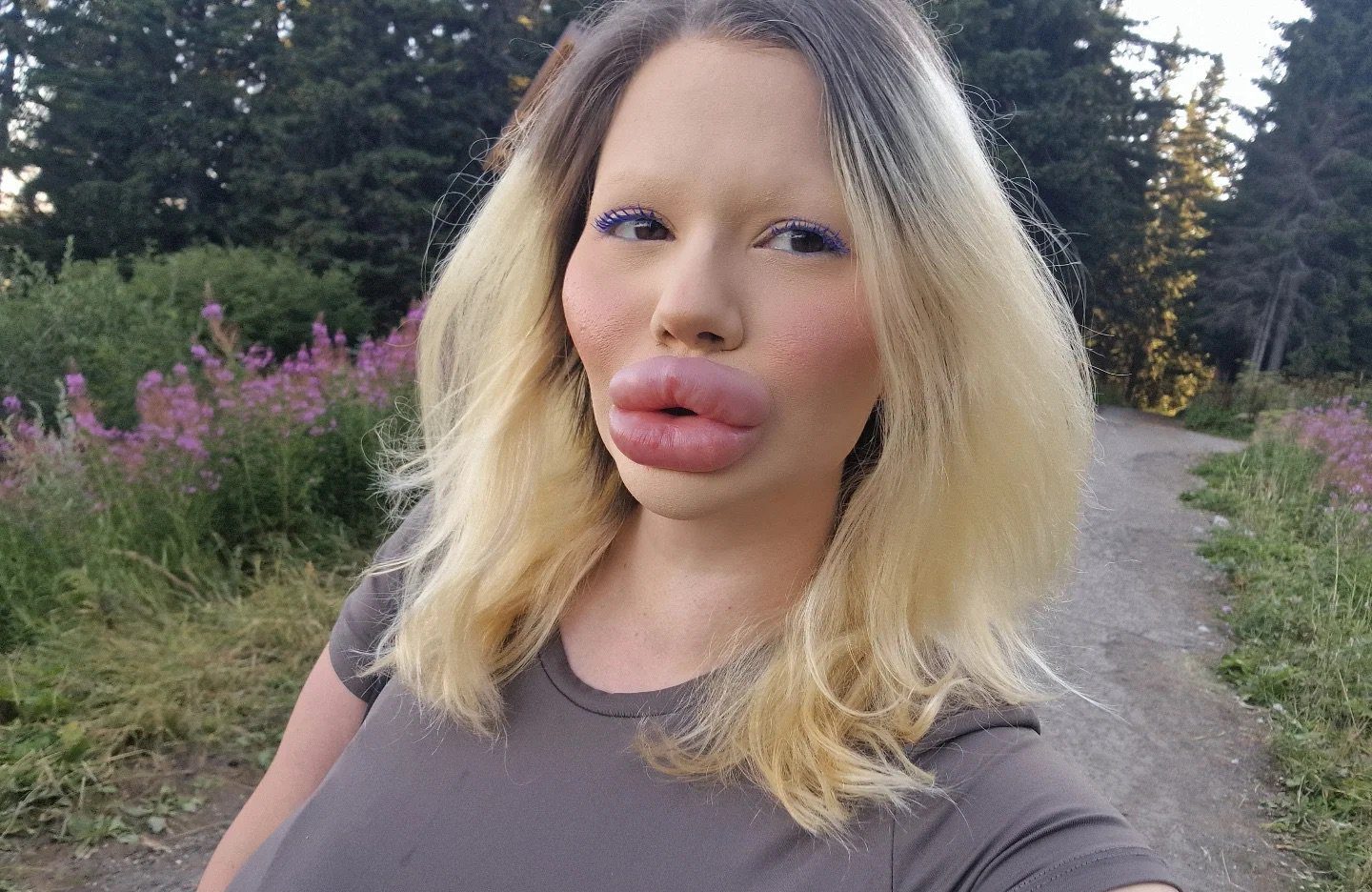 Woman spends £20k on world's biggest lips
