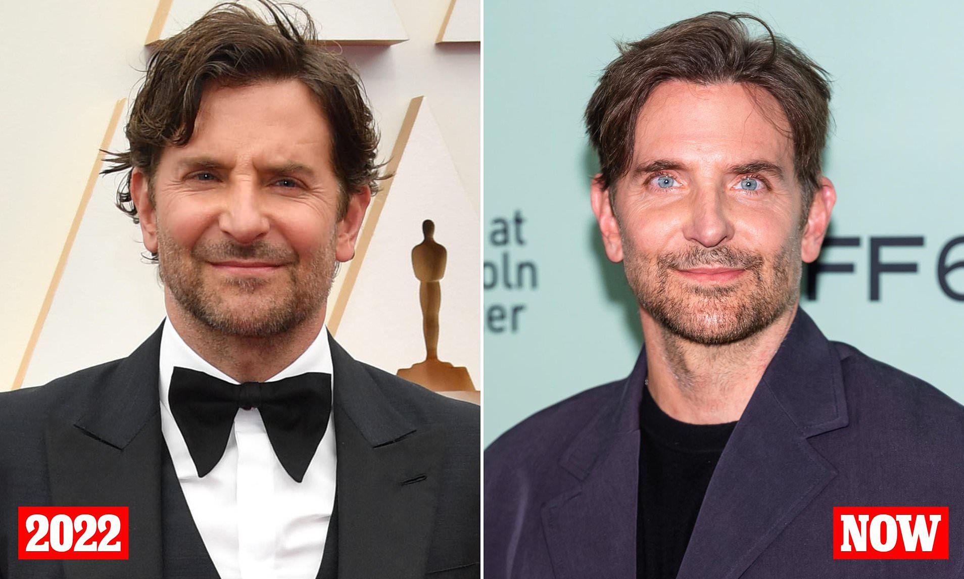 Why does Bradley Cooper look SO different? Plastic surgeon gives his ...
