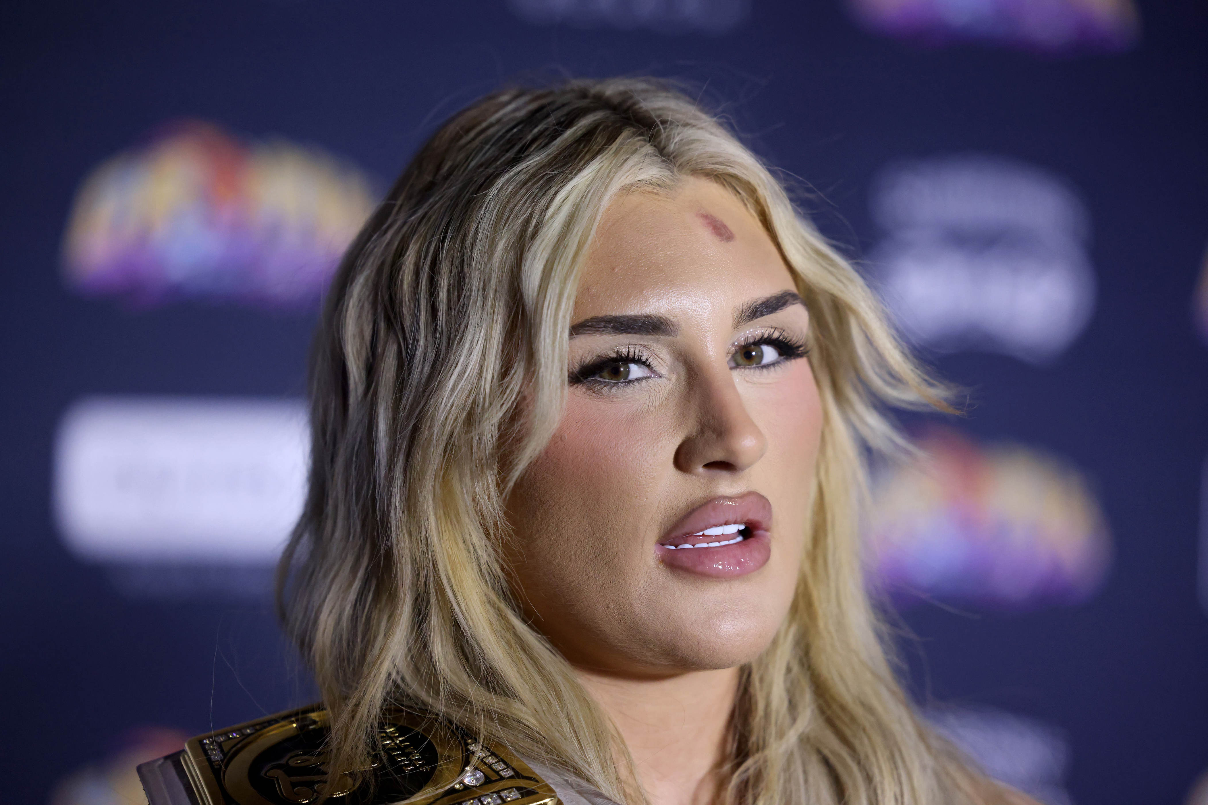 WWE gives surprising Tiffany Stratton injury update after SmackDown