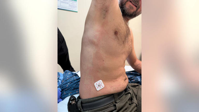 Couple caught in the act; partial human remains found | Nightly Roundup