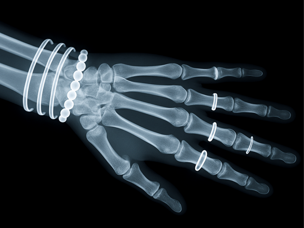 5 diseases your fingers could be warning you about