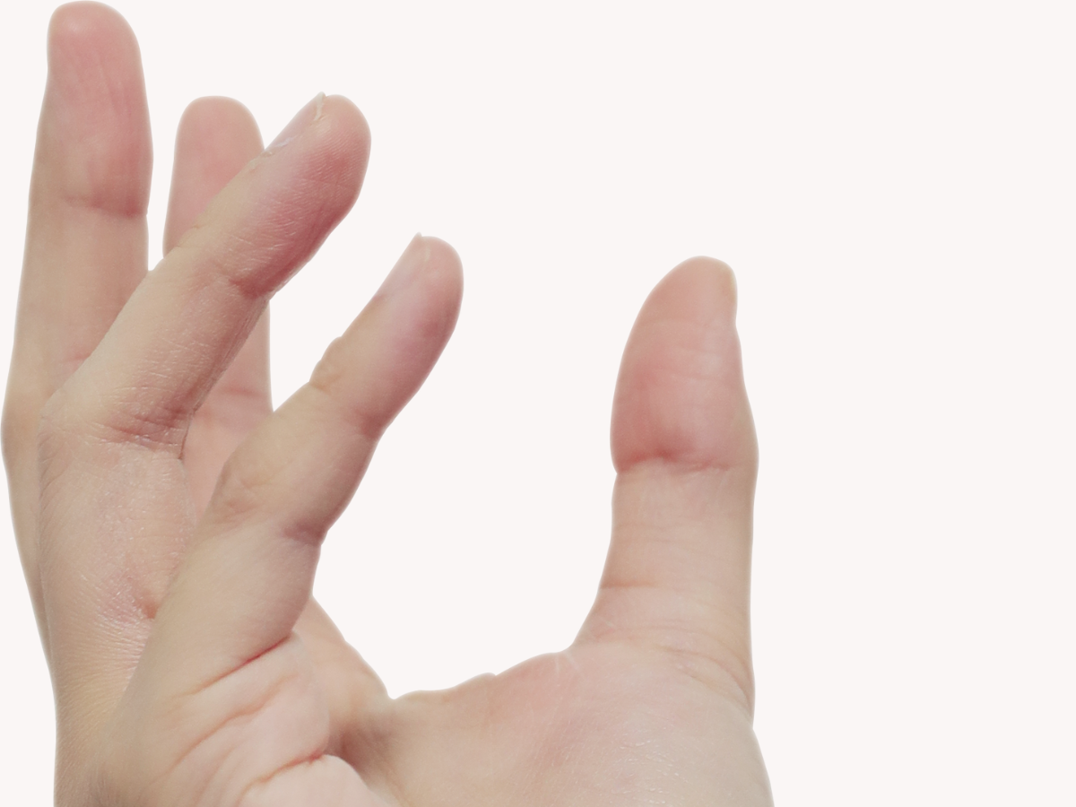 5 diseases your fingers could be warning you about