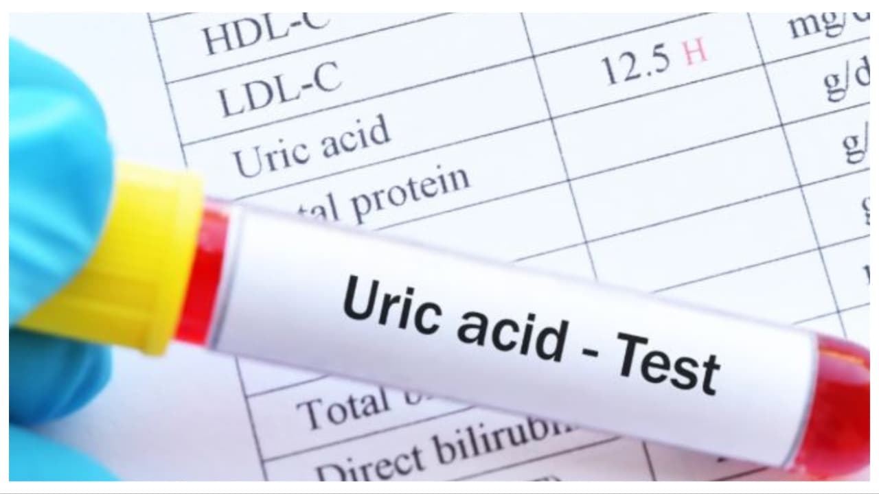 High Uric Acid? Avoid These Six Common Foods That Raise Levels Fast