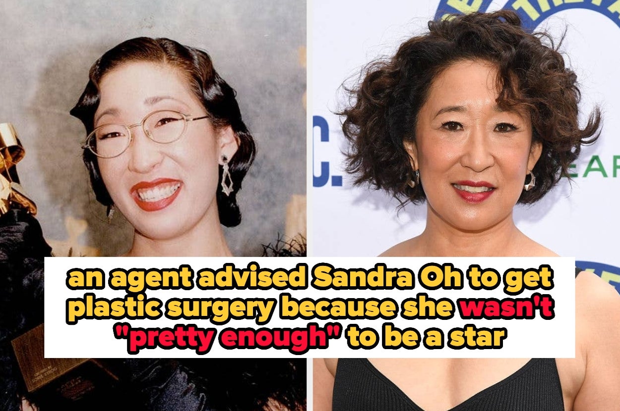 19 Actors Who Were Told To Get Cosmetic Surgery But Refused