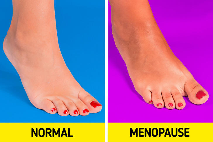 10 Early Menopause Symptoms You’re Probably Overlooking